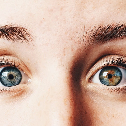 ¿Por qué se puede tener un ojo de cada color o heterocromía? - Vithas ...